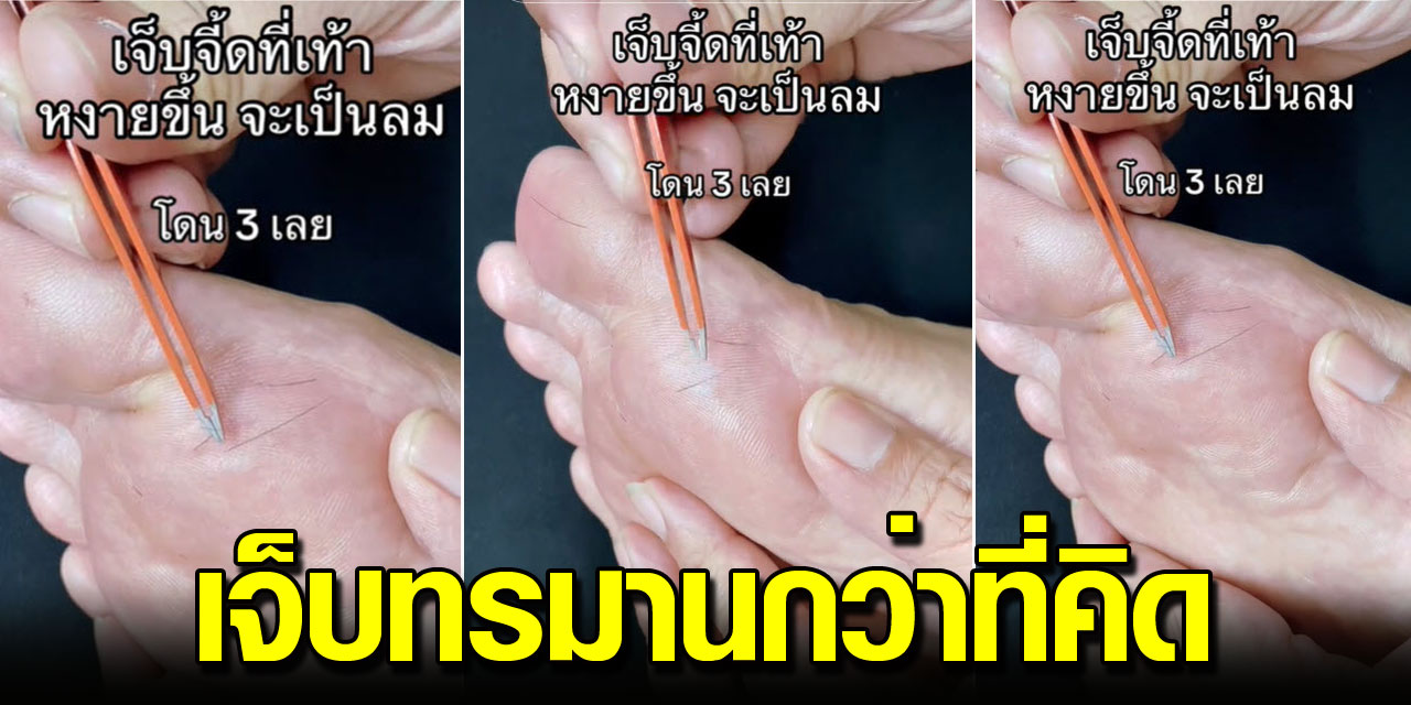 เมื่อรู้สึกเจ็บจี๊ดๆที่เท้า พอรู้สาเหตุทรมานกว่าที่คิด